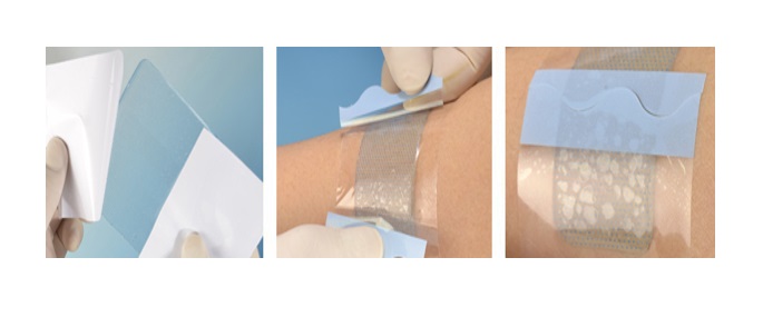 Hydrogel gauze wound dressing first aid burn dressing hydrogel for dry ...