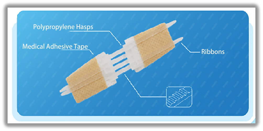 Buy zipstitch adhesive skin wound closure device popular sizes