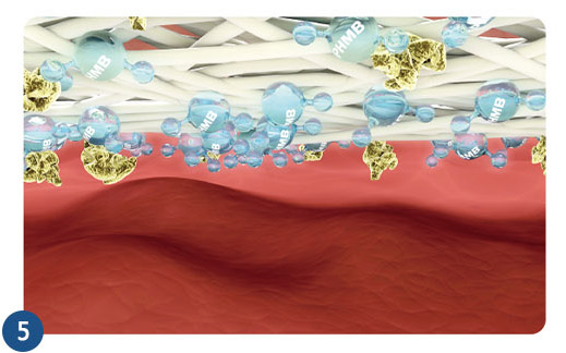 PHMB dressing Antimicrobial Alginate Dressings anti bacteria dressing