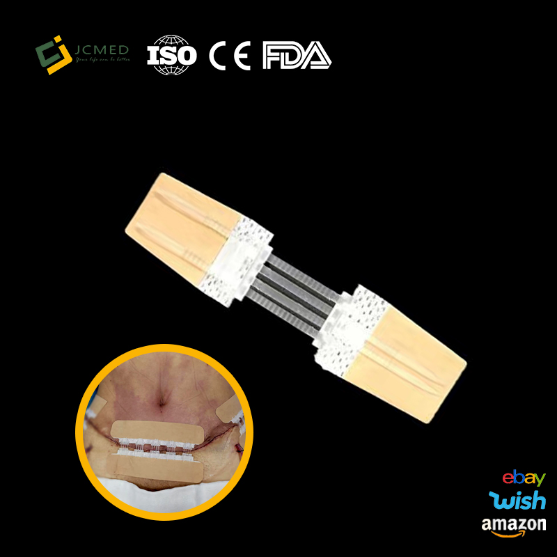 wound closure device zip stitch wound care with FDA