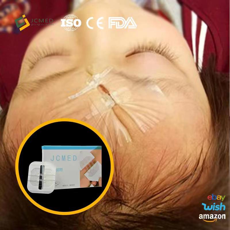 zipstitch wound closure zip tie wound care with FDA