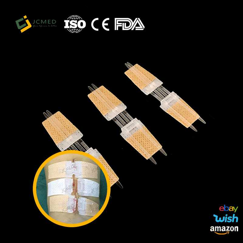 Wound closures with adjustable reversible hasps