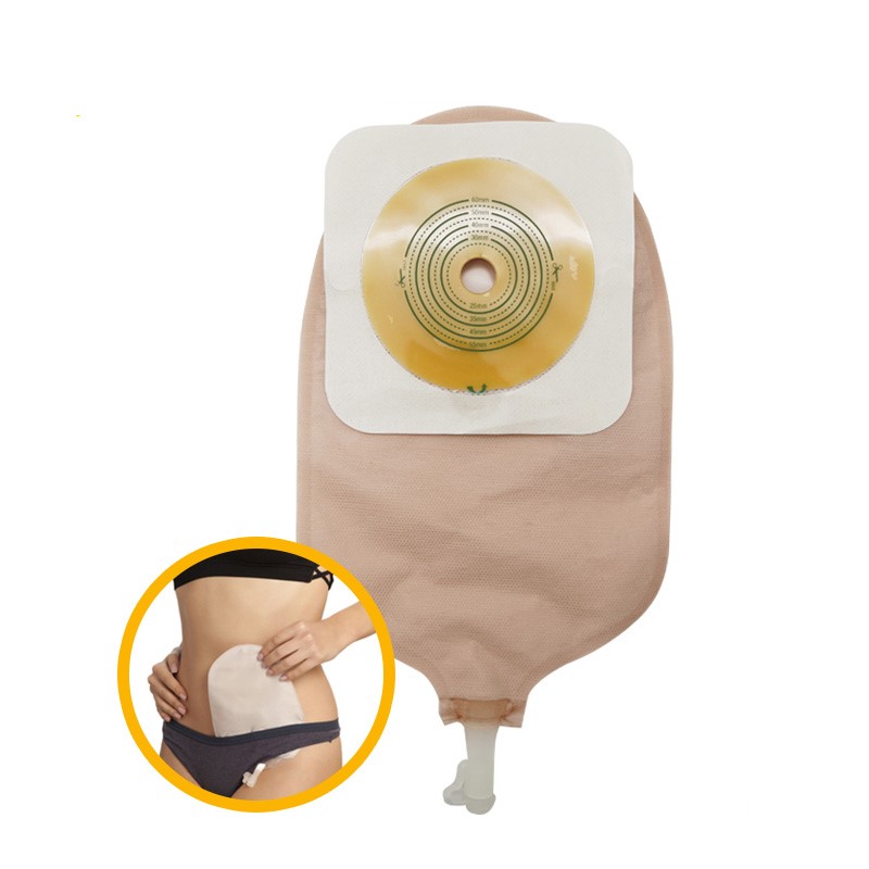 ileostomy bag urostomy Ostomy bag two piece drainable pouch closed ...