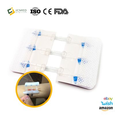 zipstitch wound closure zip tie wound care with FDA