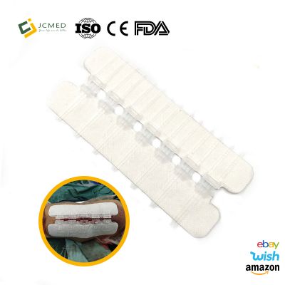 Zip tie sutures painless skin wound closure device