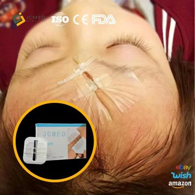 zip tie stitches zip stitch wound closure device for laceration